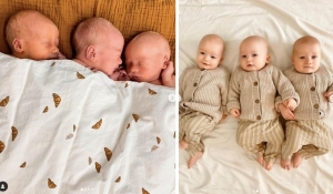 Triplet Pregnancy - Mum's Beautiful Belly Shots, Before and After